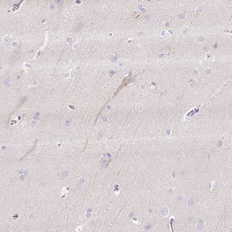 Anti-HEXB | Scientist.com