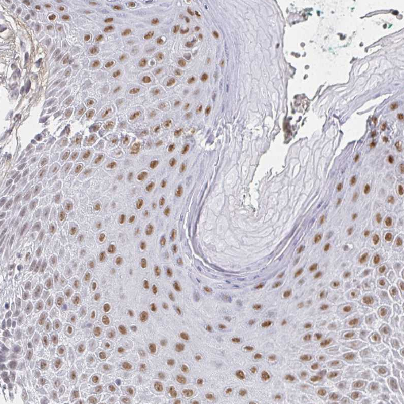 Anti-RCOR1 | Scientist.com