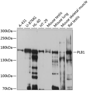 PLB1 Rabbit pAb | Scientist.com