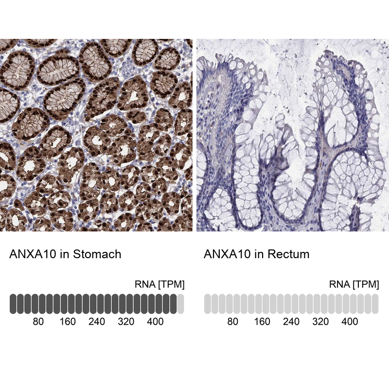 Anti-ANXA10 | Scientist.com