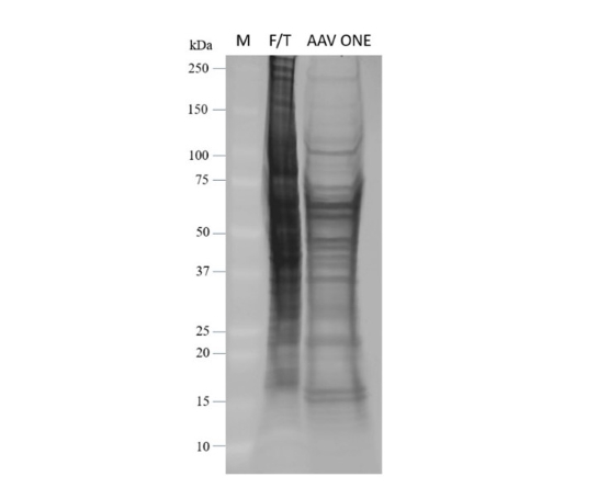 AAV ONE-Extract™ Solution | Scientist.com