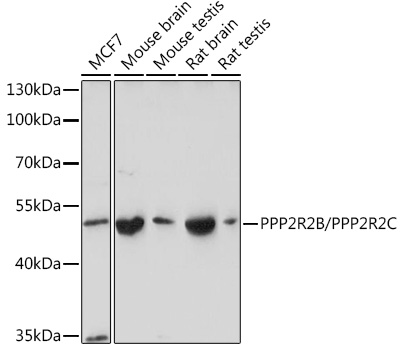 PPP2R2B/PPP2R2C Rabbit pAb | Scientist.com