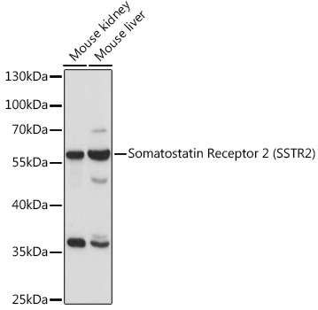 Somatostatin Receptor 2 (SSTR2) Rabbit pAb | Scientist.com