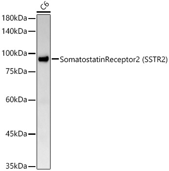 Somatostatin Receptor 2 (SSTR2) Rabbit mAb | Scientist.com