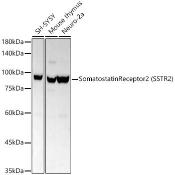 Somatostatin Receptor 2 (SSTR2) Rabbit mAb | Scientist.com