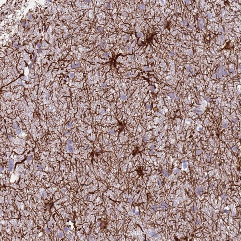 Anti-TAS2R38 | Scientist.com