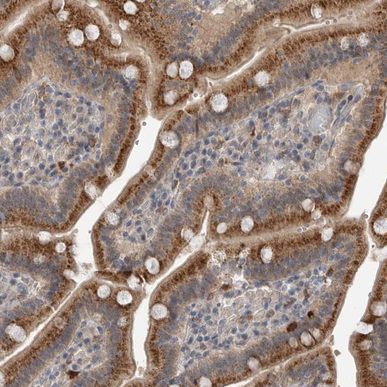 Anti-SCP2 | Scientist.com