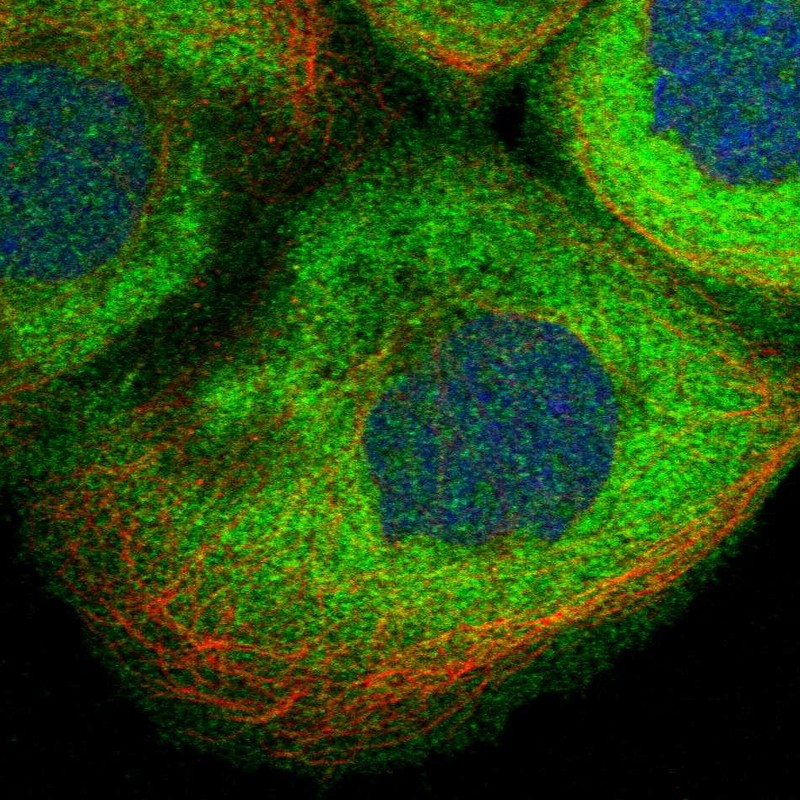 Anti-CDV3 | Scientist.com