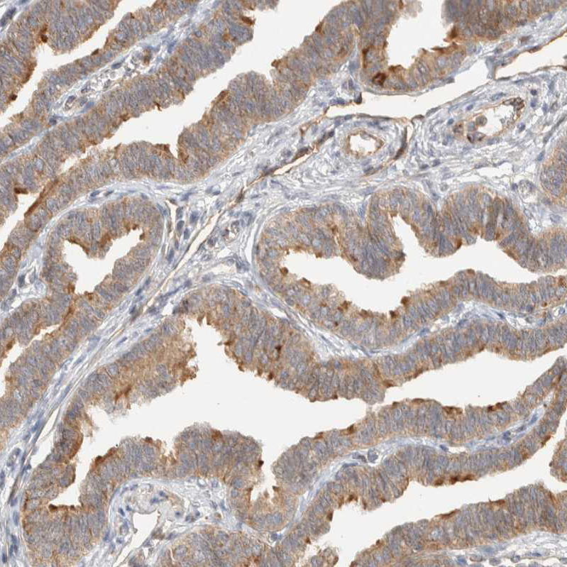 Anti-KIF9 | Scientist.com