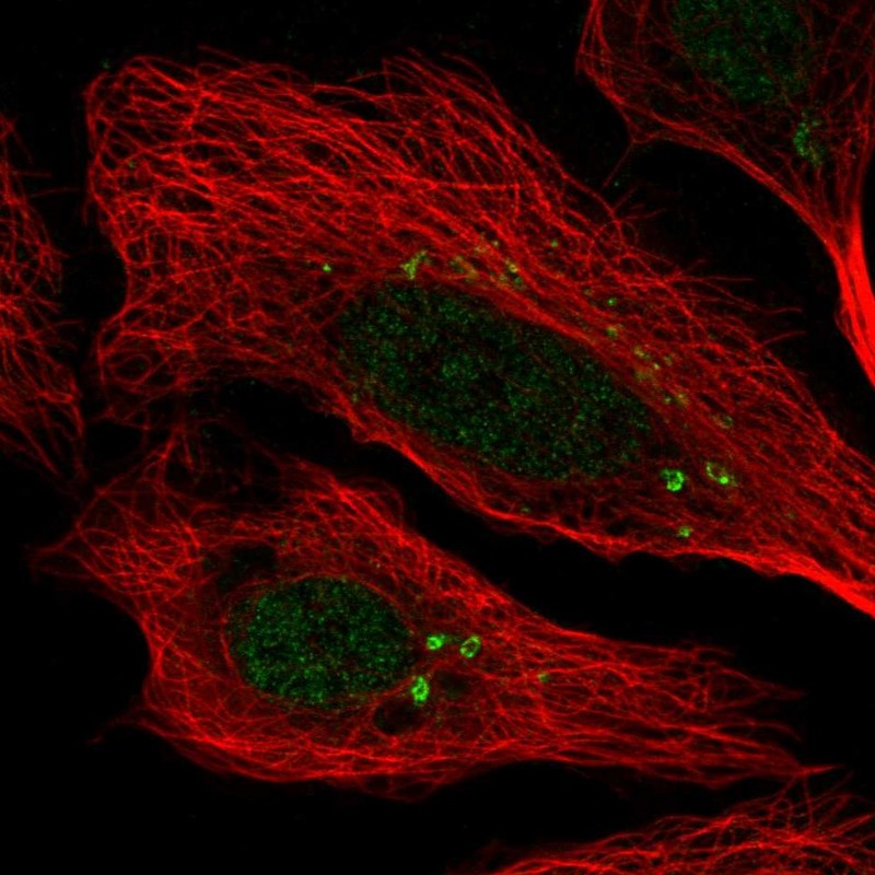 Anti-CEP112 | Scientist.com