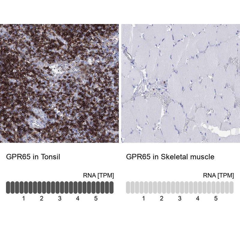 Anti-GPR65 | Scientist.com