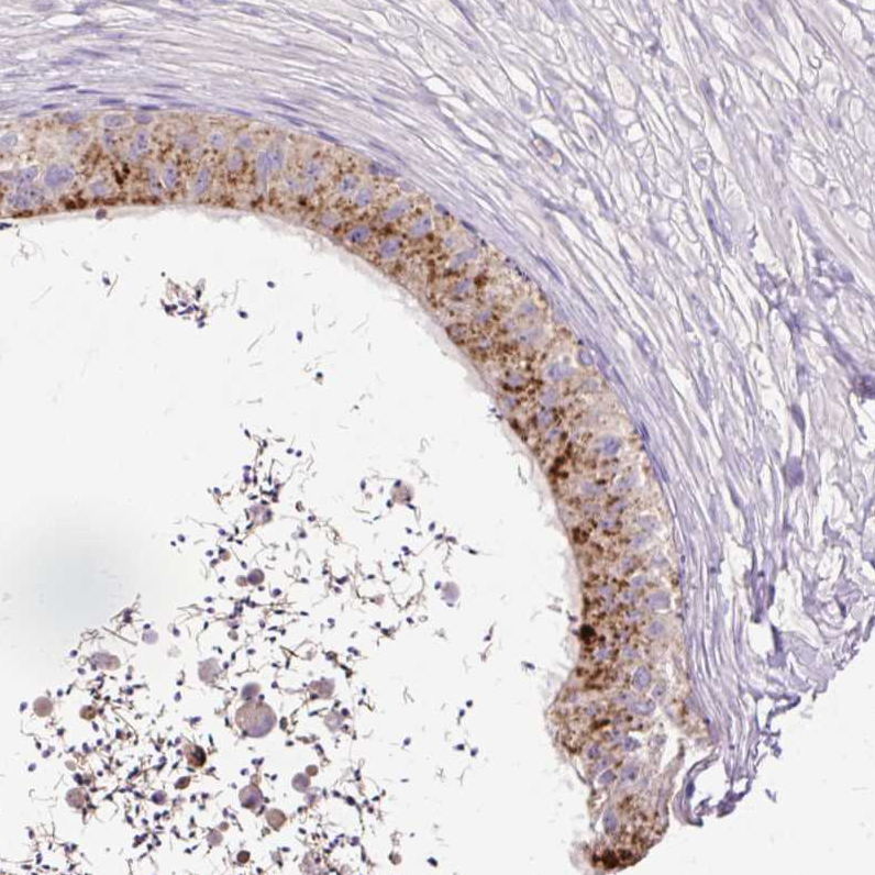 Anti-HEXB | Scientist.com