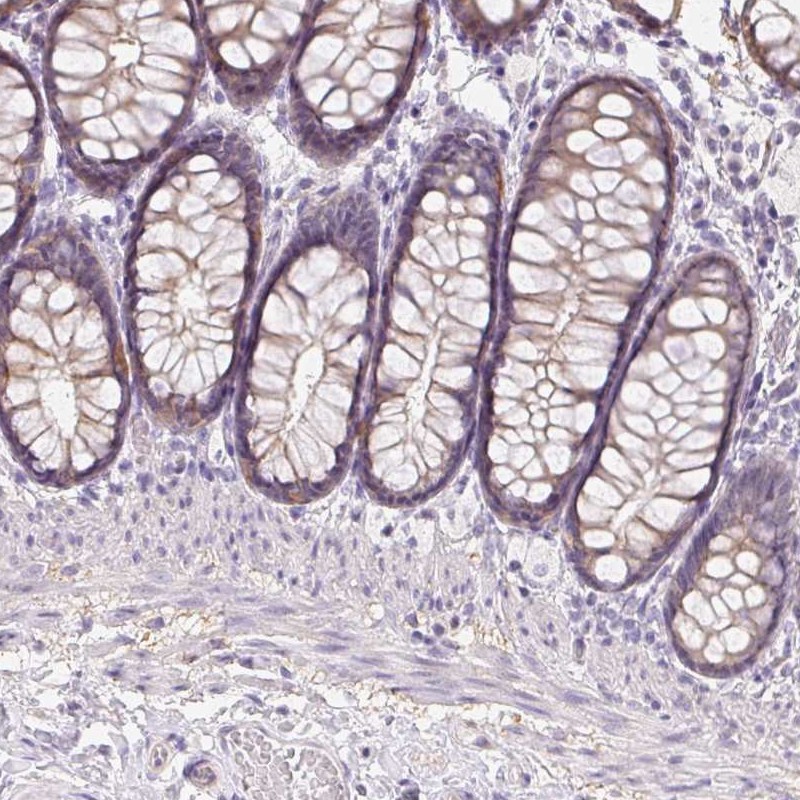 Anti-ZBBX | Scientist.com