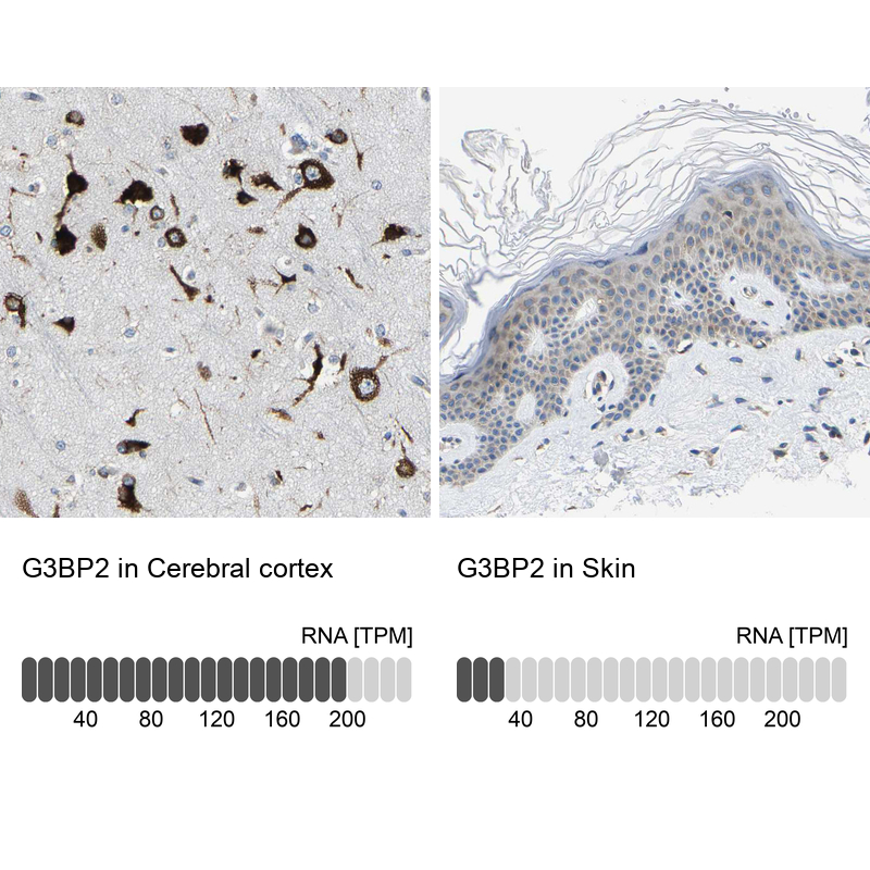 Anti-G3BP2 | Scientist.com
