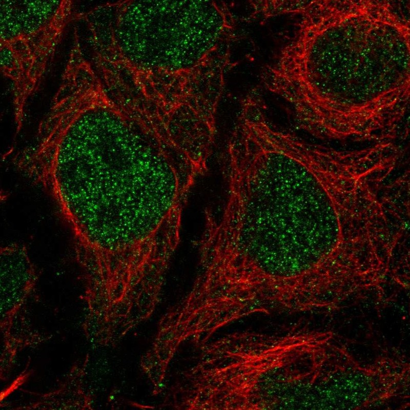 Anti-TMEM8A | Scientist.com