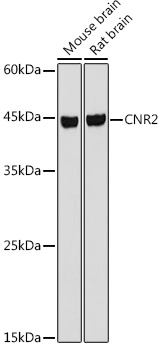 CNR2 Rabbit pAb | Scientist.com