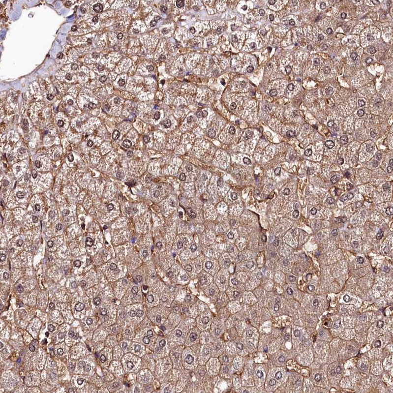 Anti-ANO6 | Scientist.com